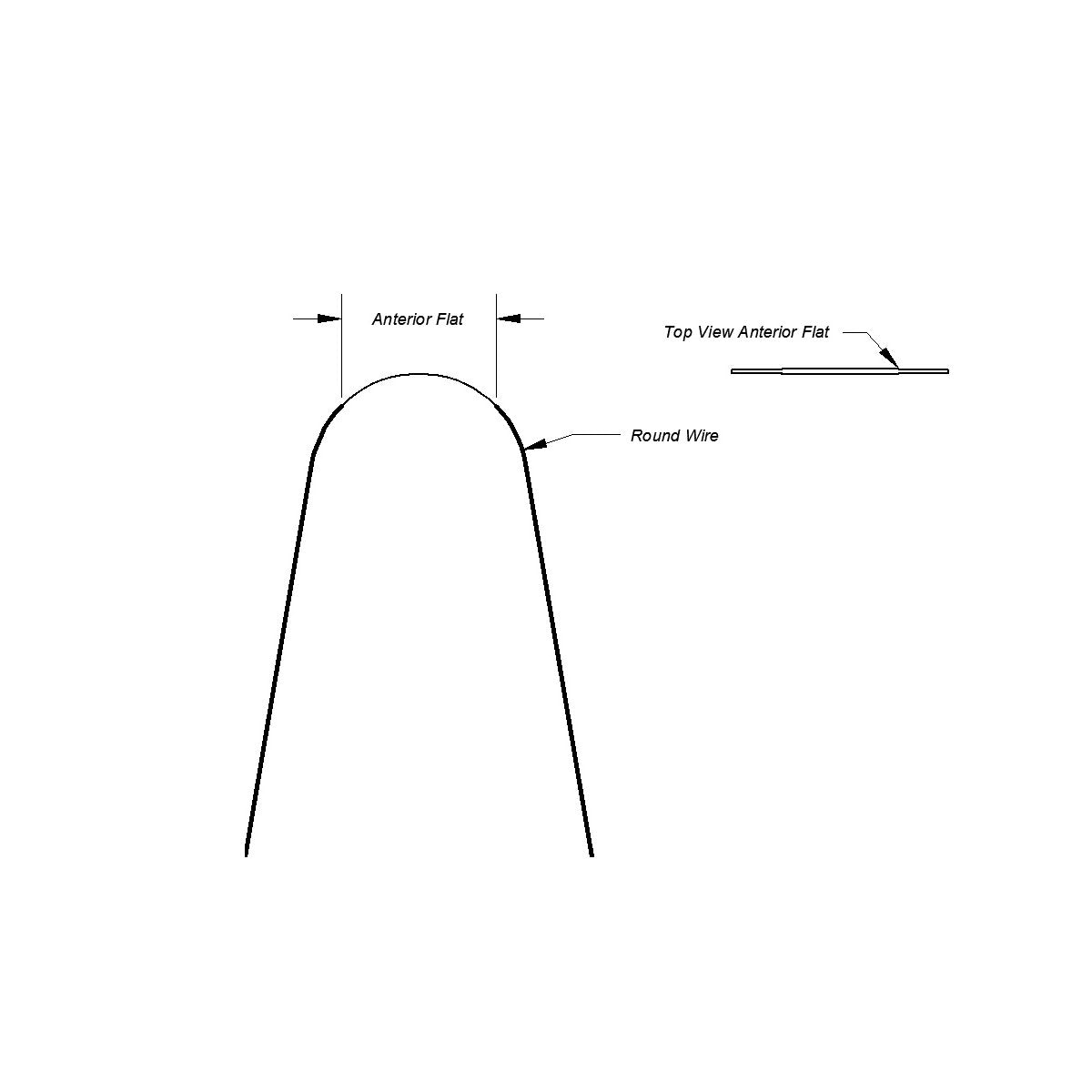New Product Alert* Loopless Flat Bow Archwire – JAW Products